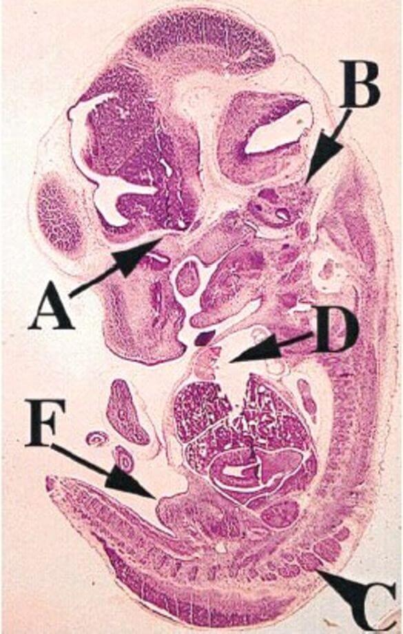 Universitätsklinikum Heidelberg: SHOX regulation in short stature